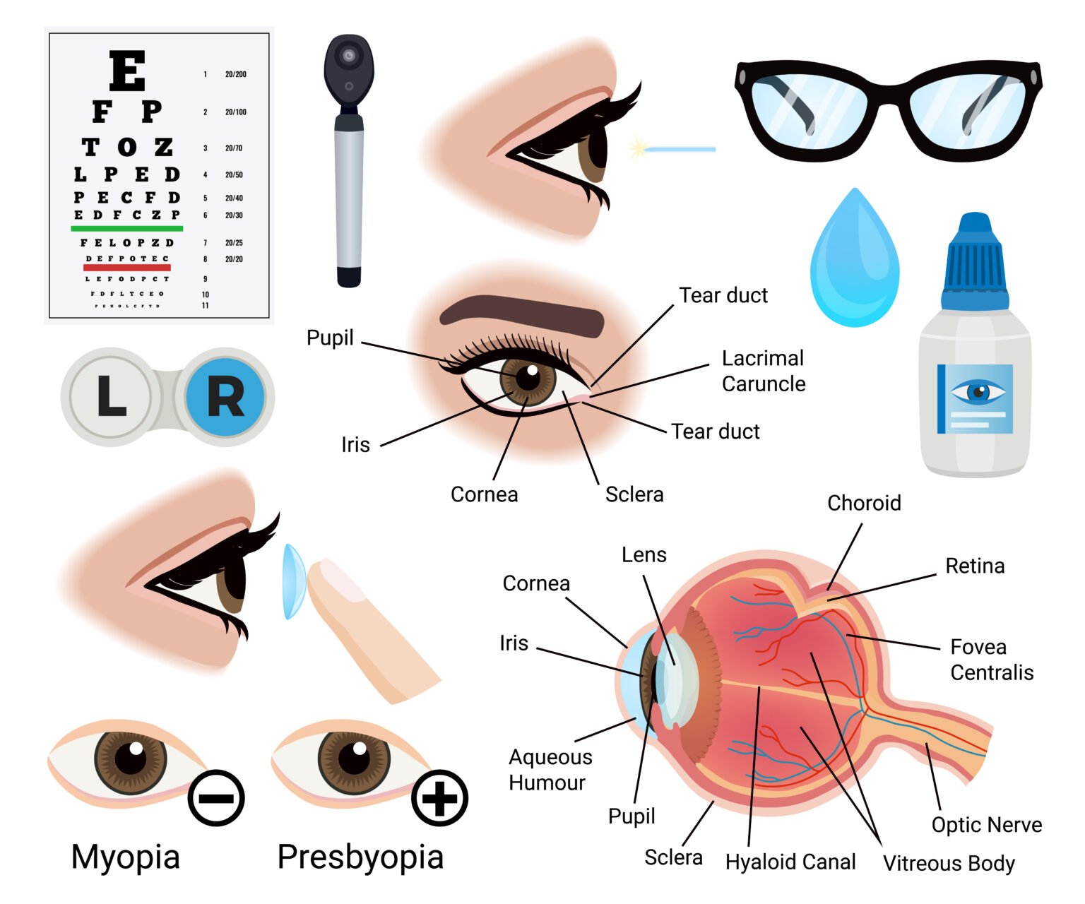 Refractive Errors: Types, Causes, Effects And Treatment